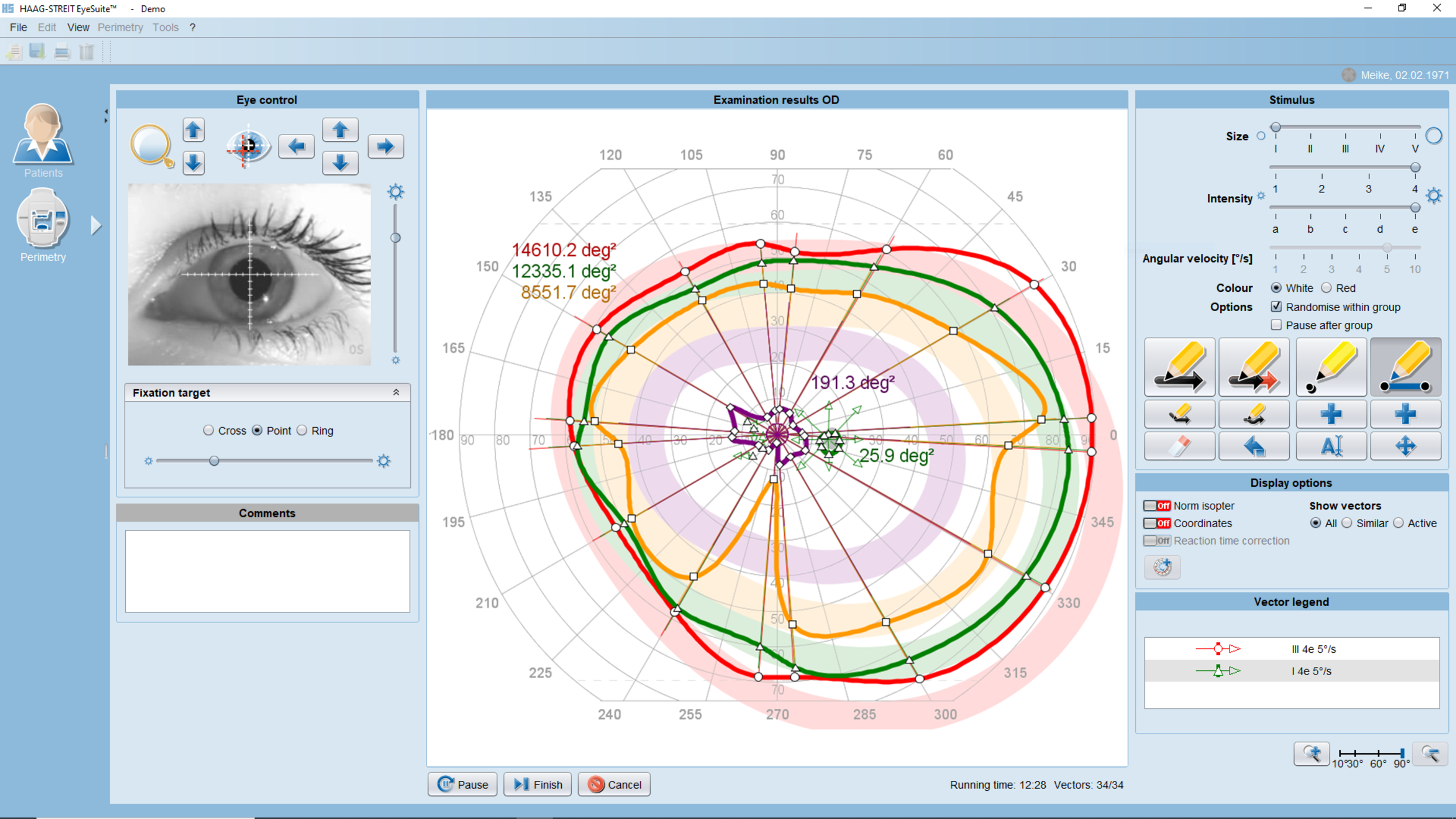 Octopus 900 - Kinetic perimetry